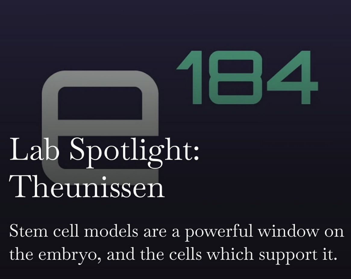 Interview with e184 – Theunissen Lab
